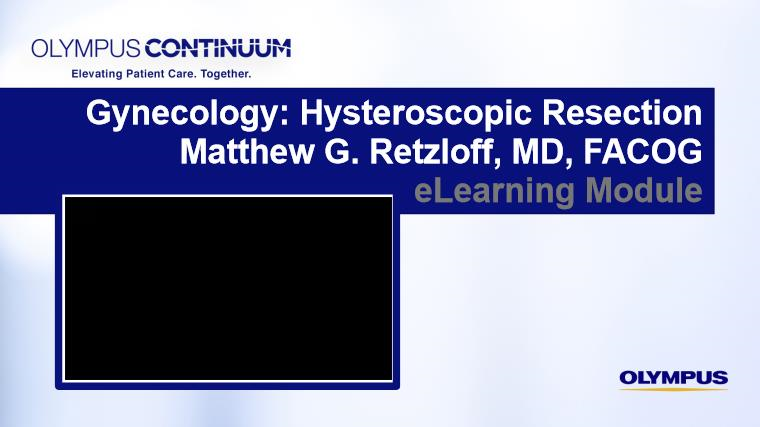 Hysteroscopic Resection