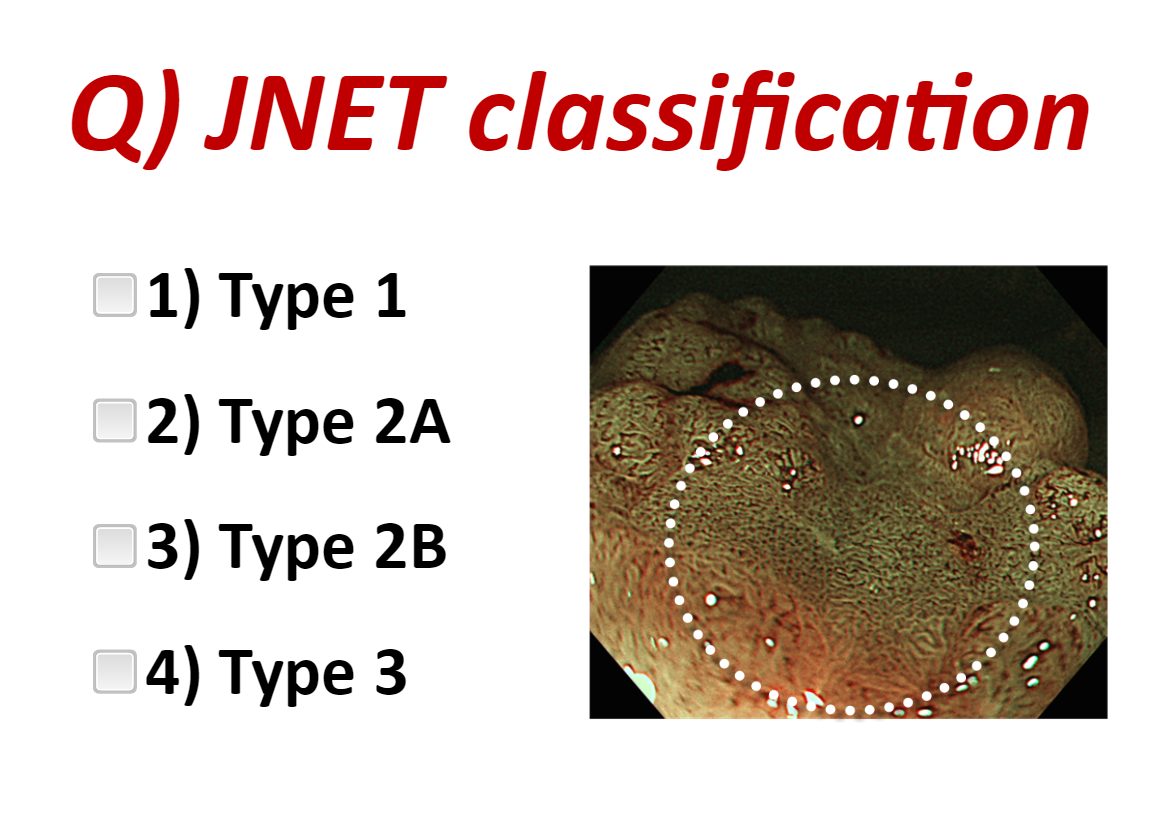 JNET分類 E-learning(自己学習) - Olympus Professional Education On-Demand Library