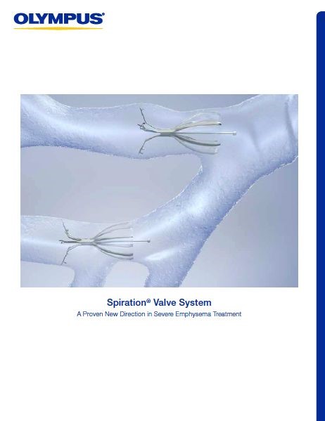 Procedimento e tecnologia do Spiration Valve System - Formação ...