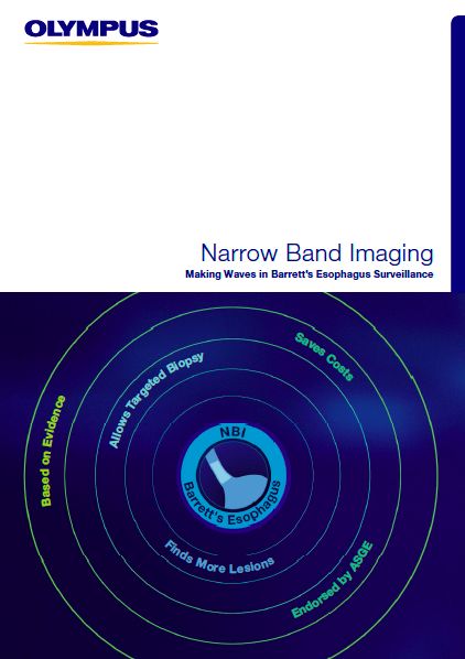 Narrow Band Imaging - Making Waves in Barrett’s Esophagus Surveillance ...