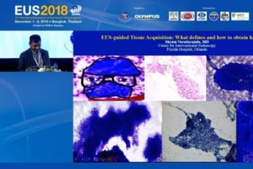 Uncinate Process Sampling with EZ Shot 3 Plus - OLYMPUS Professional ...