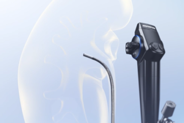 Flexible Ureteroscopy Procedural Steps in Detail - Olympus Professional ...