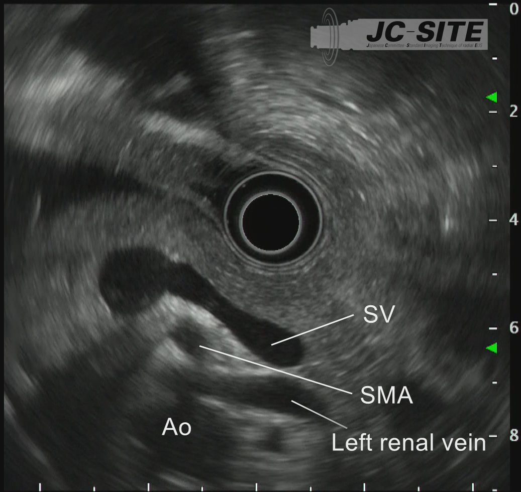 Standard Imaging Methods in the Pancreatobiliary Region Using Radial ...