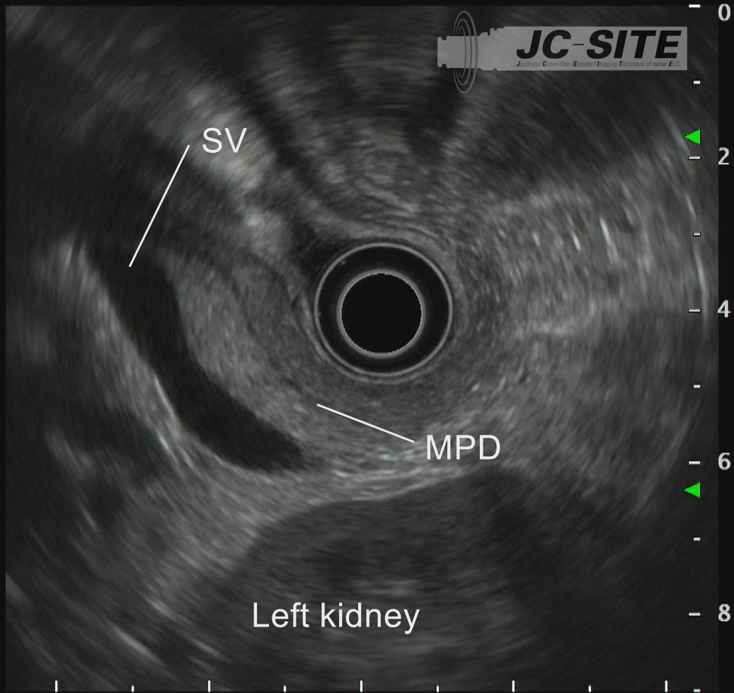 Standard Imaging Methods in the Pancreatobiliary Region Using Radial ...