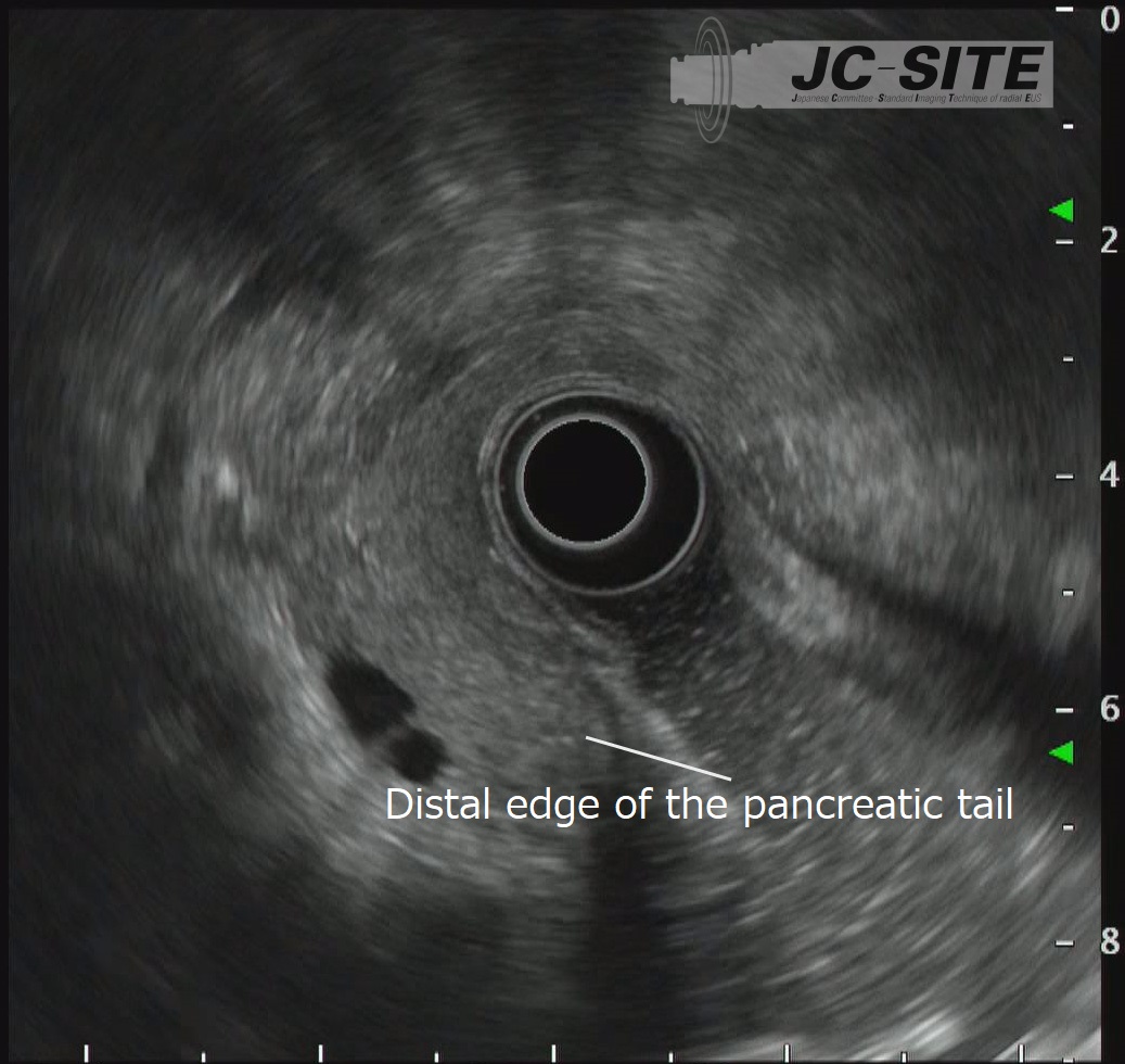Standard Imaging Methods in the Pancreatobiliary Region Using Radial ...
