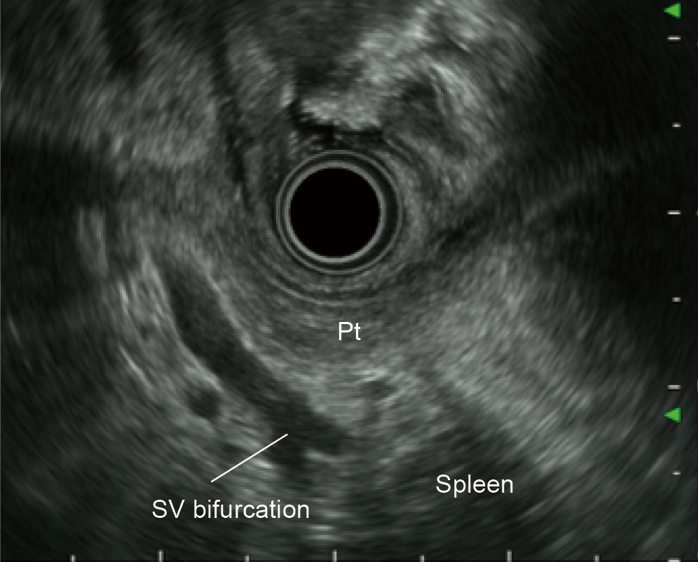 Standard Imaging Methods in the Pancreatobiliary Region Using Radial ...