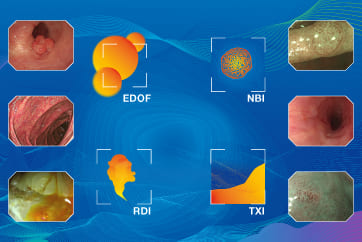 EndoClot® Submucosal Injection Solution (SIS) Quick Reference Guide ...