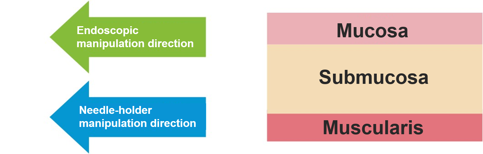 Basic operation and techniques for Endoscopic Hand-Suturing with ...