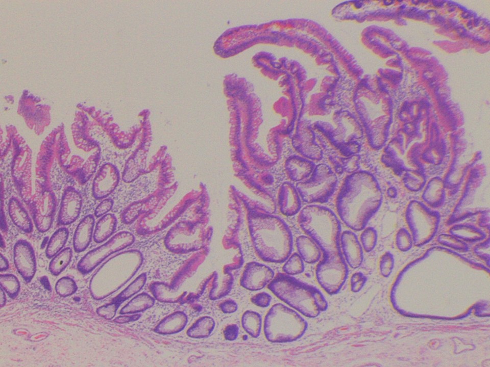 Colorectal Cases - Olympus Professional Education On-Demand Library
